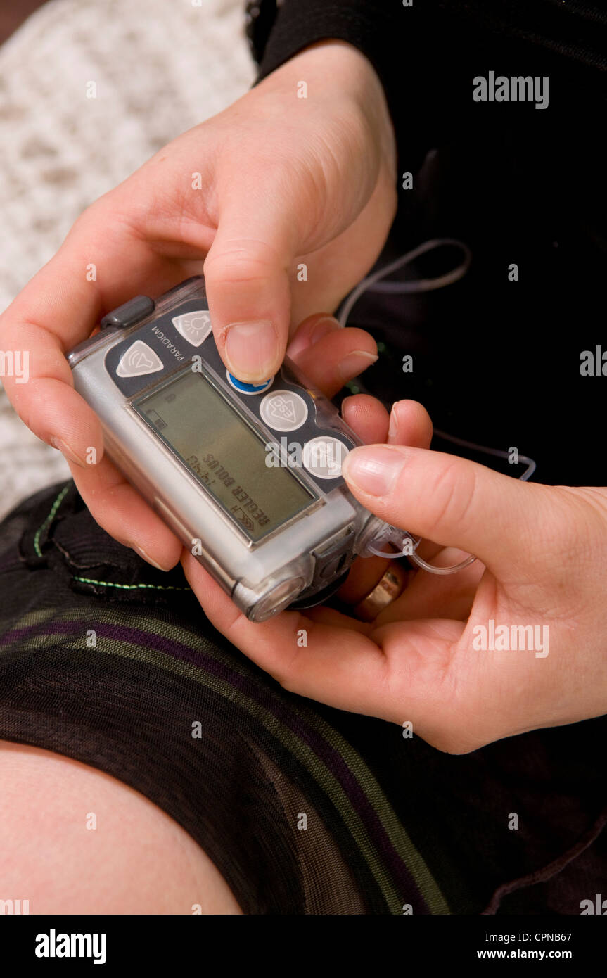 External Insulin Pump High Resolution Stock Photography and Images - Alamy