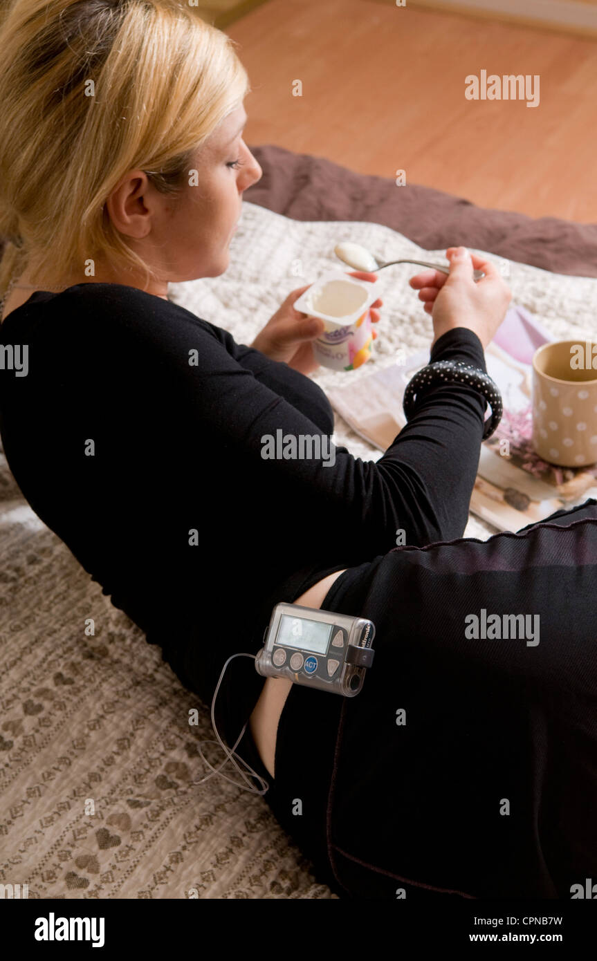 EXTERNAL INSULIN PUMP Stock Photo - Alamy