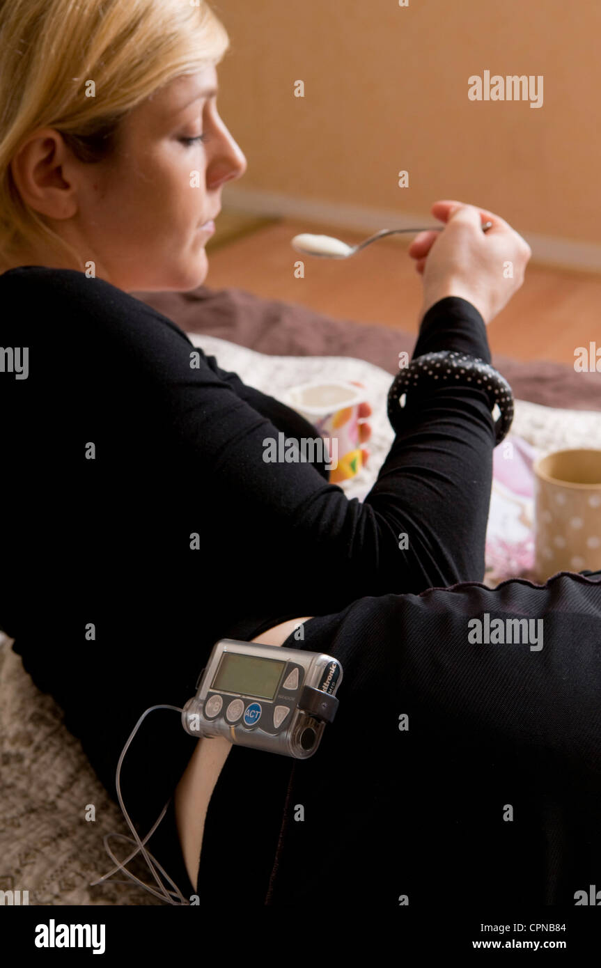 EXTERNAL INSULIN PUMP Stock Photo - Alamy