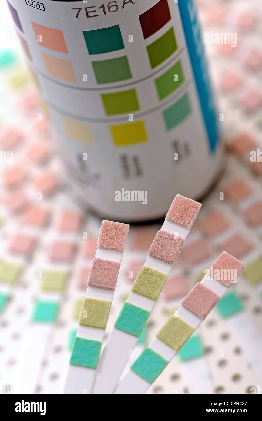 URINE TEST STRIP Stock Photo - Alamy