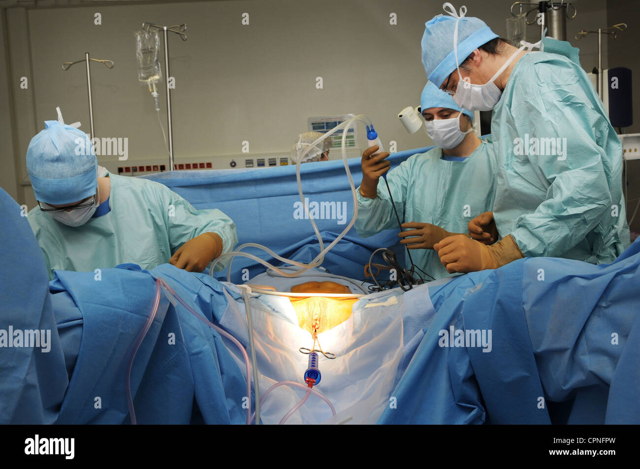 Vaginectomy hi-res stock photography and images - Alamy