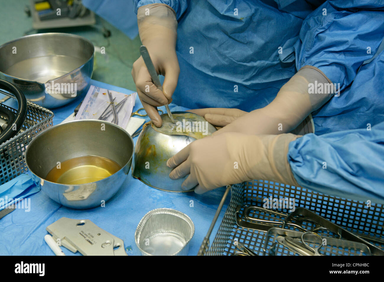 Skin grafts hi-res stock photography and images - Alamy