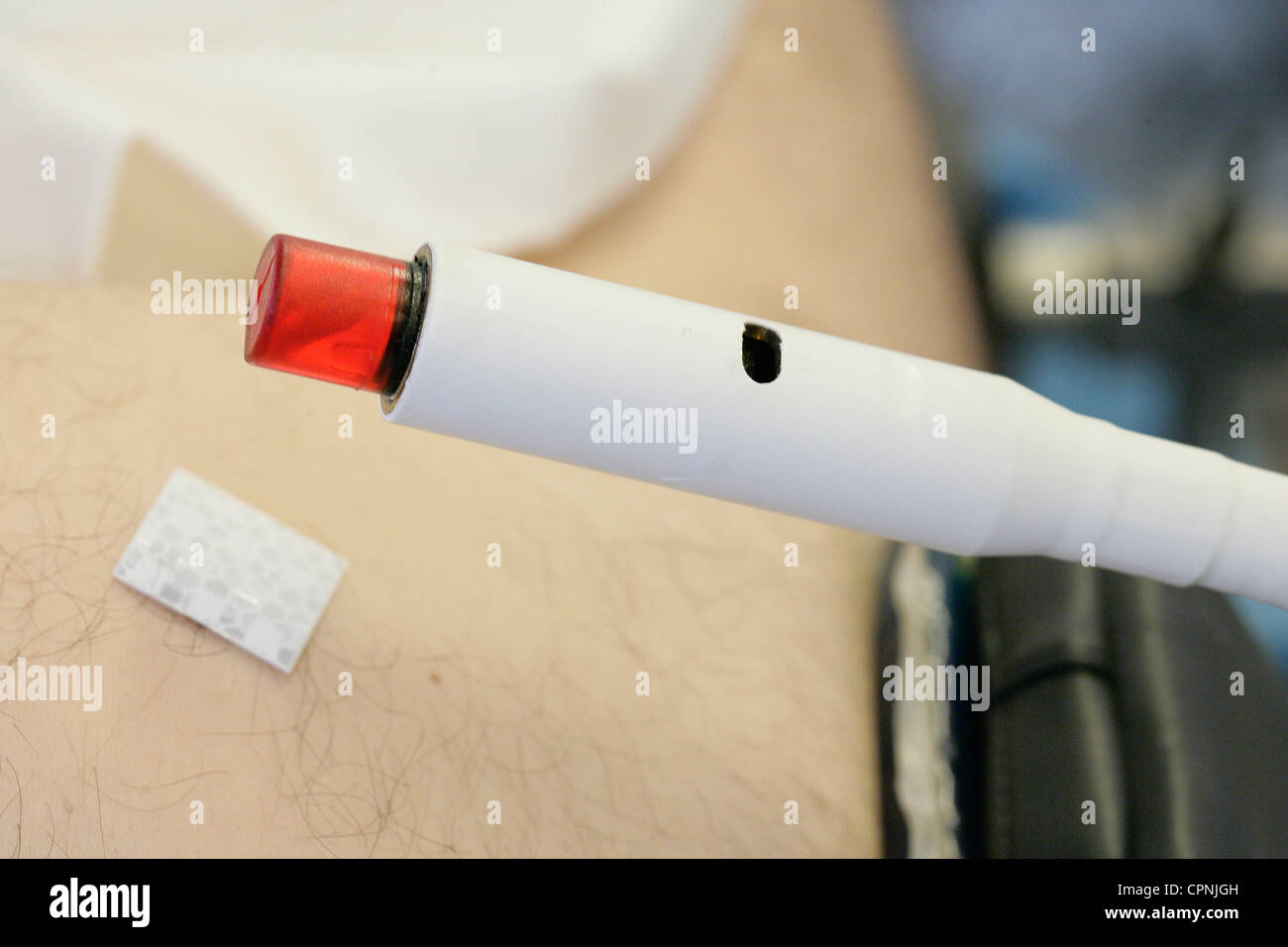 CANCER OF PROSTATE ULTRASOUND Stock Photo - Alamy