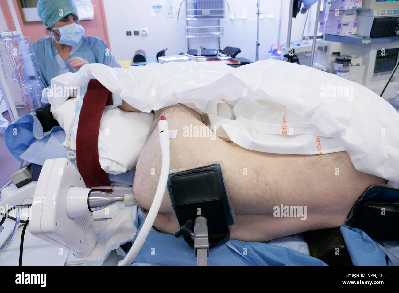 CANCER OF PROSTATE ULTRASOUND Stock Photo - Alamy