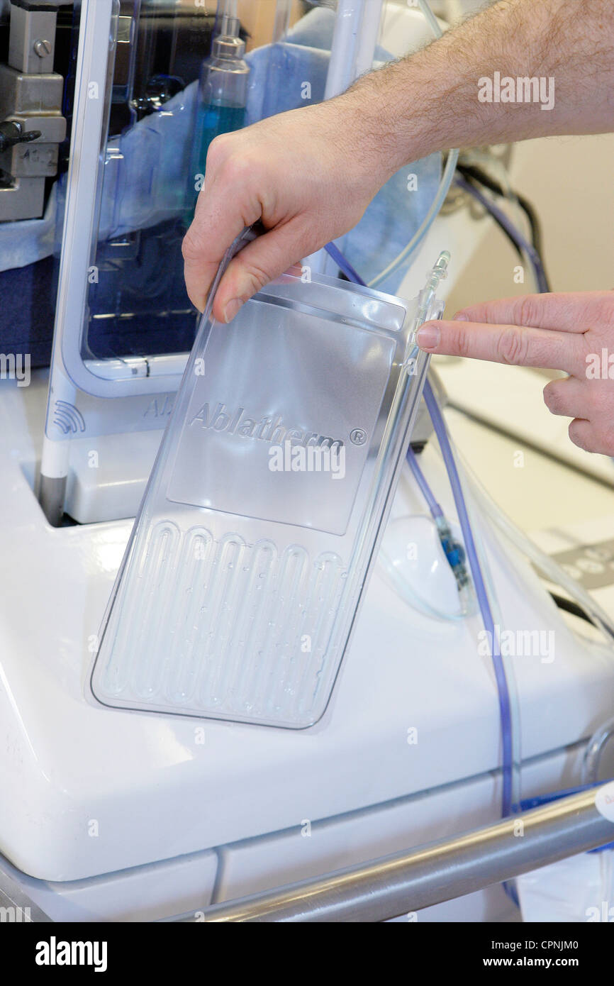 CANCER OF PROSTATE ULTRASOUND Stock Photo - Alamy