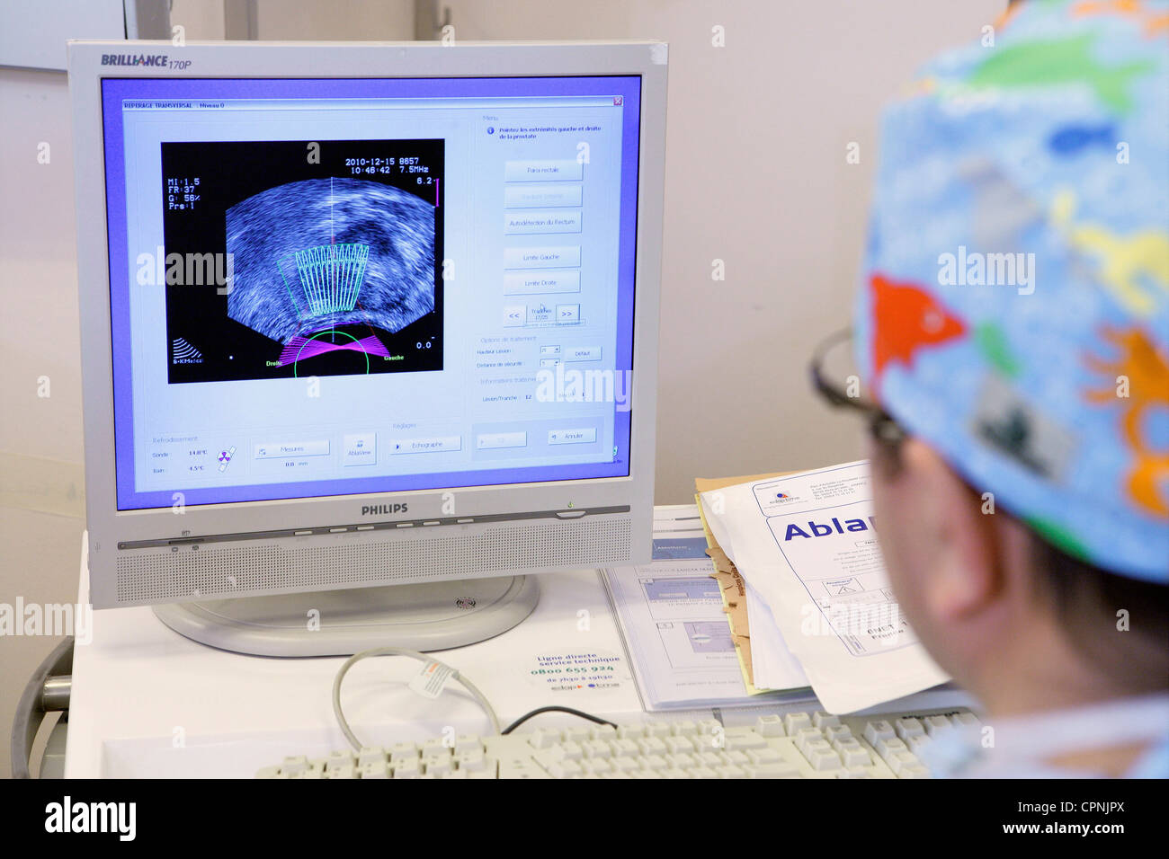 CANCER OF PROSTATE ULTRASOUND Stock Photo - Alamy