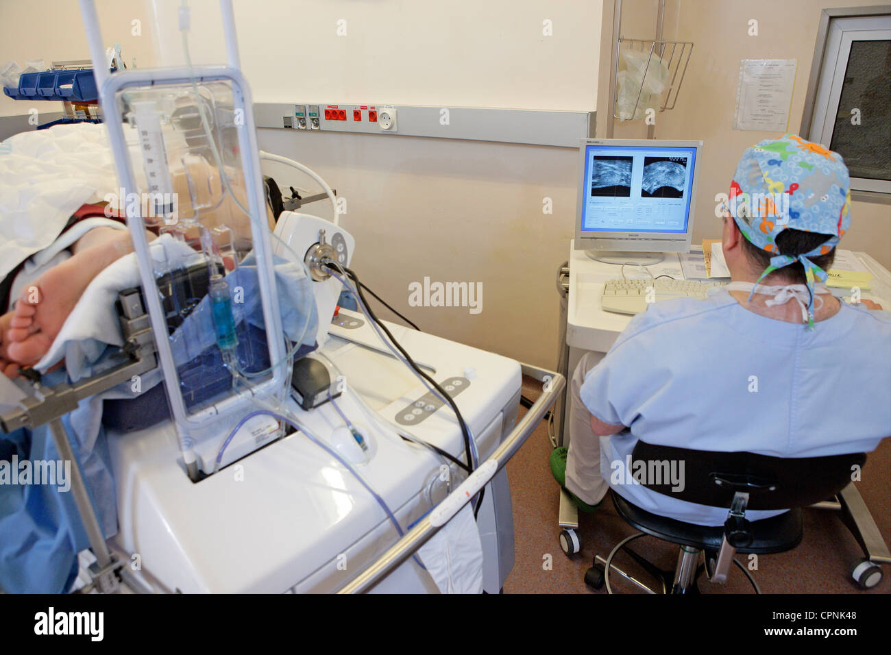 CANCER OF PROSTATE ULTRASOUND Stock Photo - Alamy