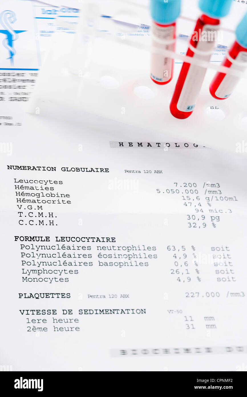 Complete blood count test tubes hi-res stock photography and images - Alamy