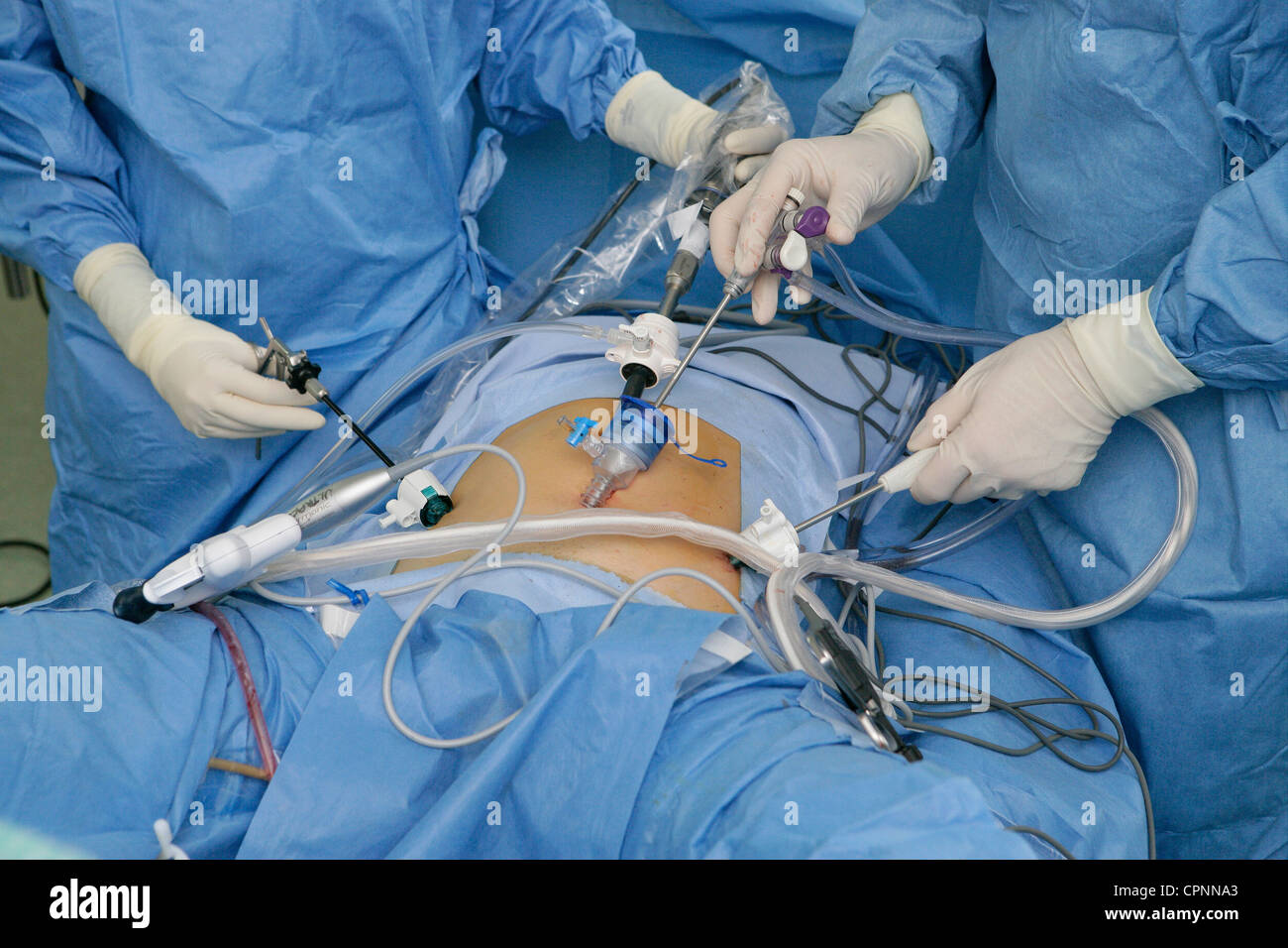 Myomectomy hi-res stock photography and images - Alamy