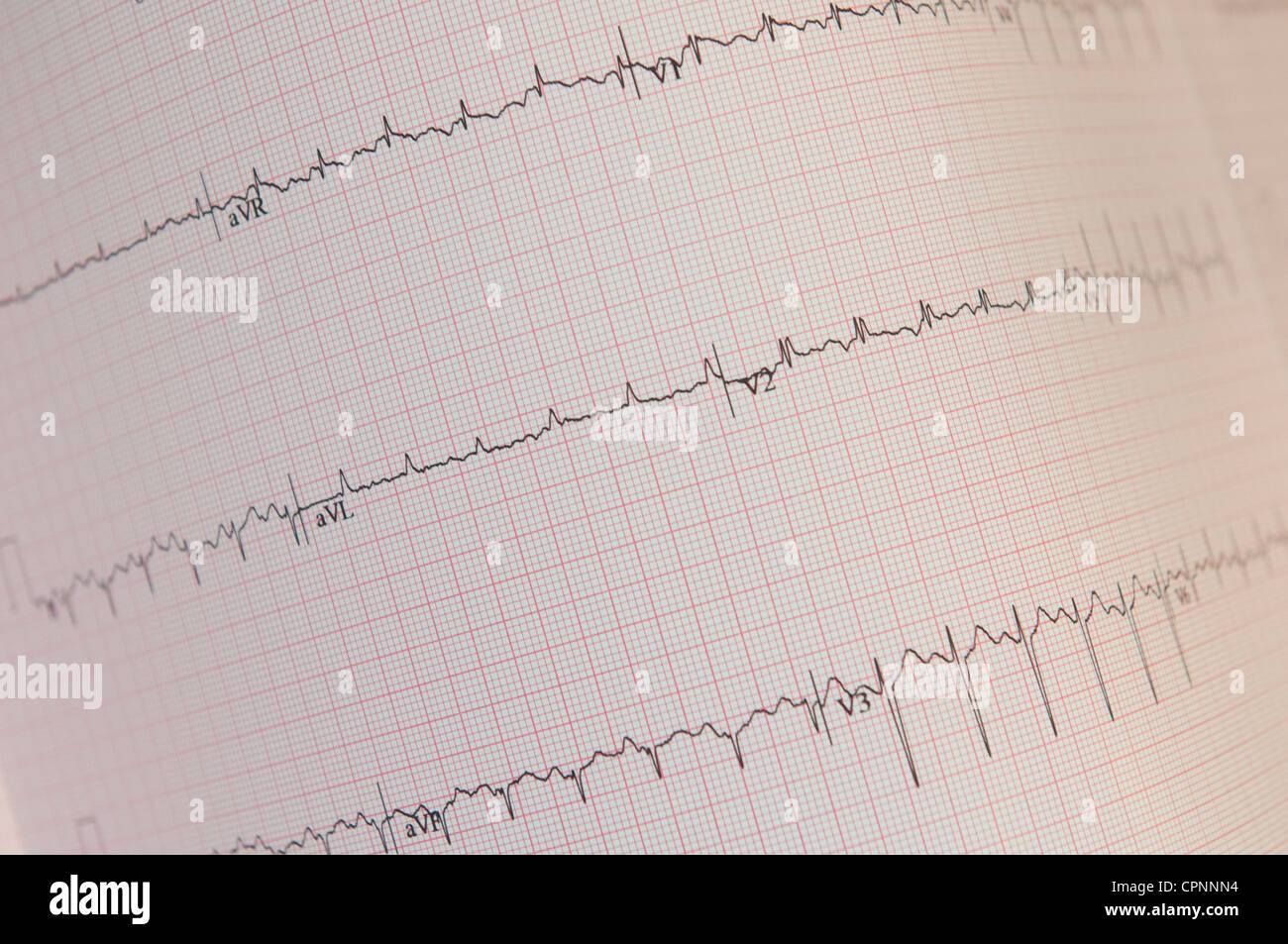 Ecg tests hi-res stock photography and images - Alamy