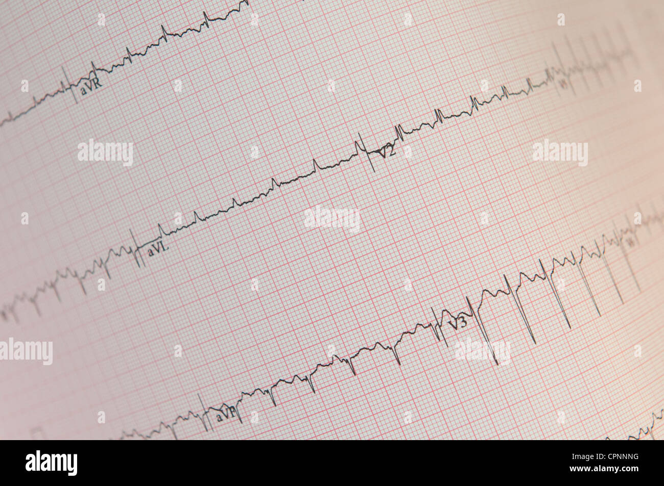 Ecg tests hi-res stock photography and images - Alamy