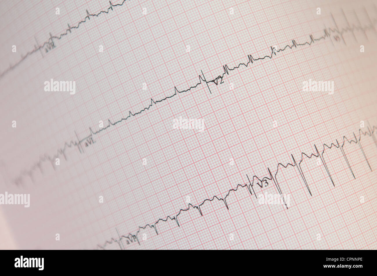 ECG Stock Photo - Alamy