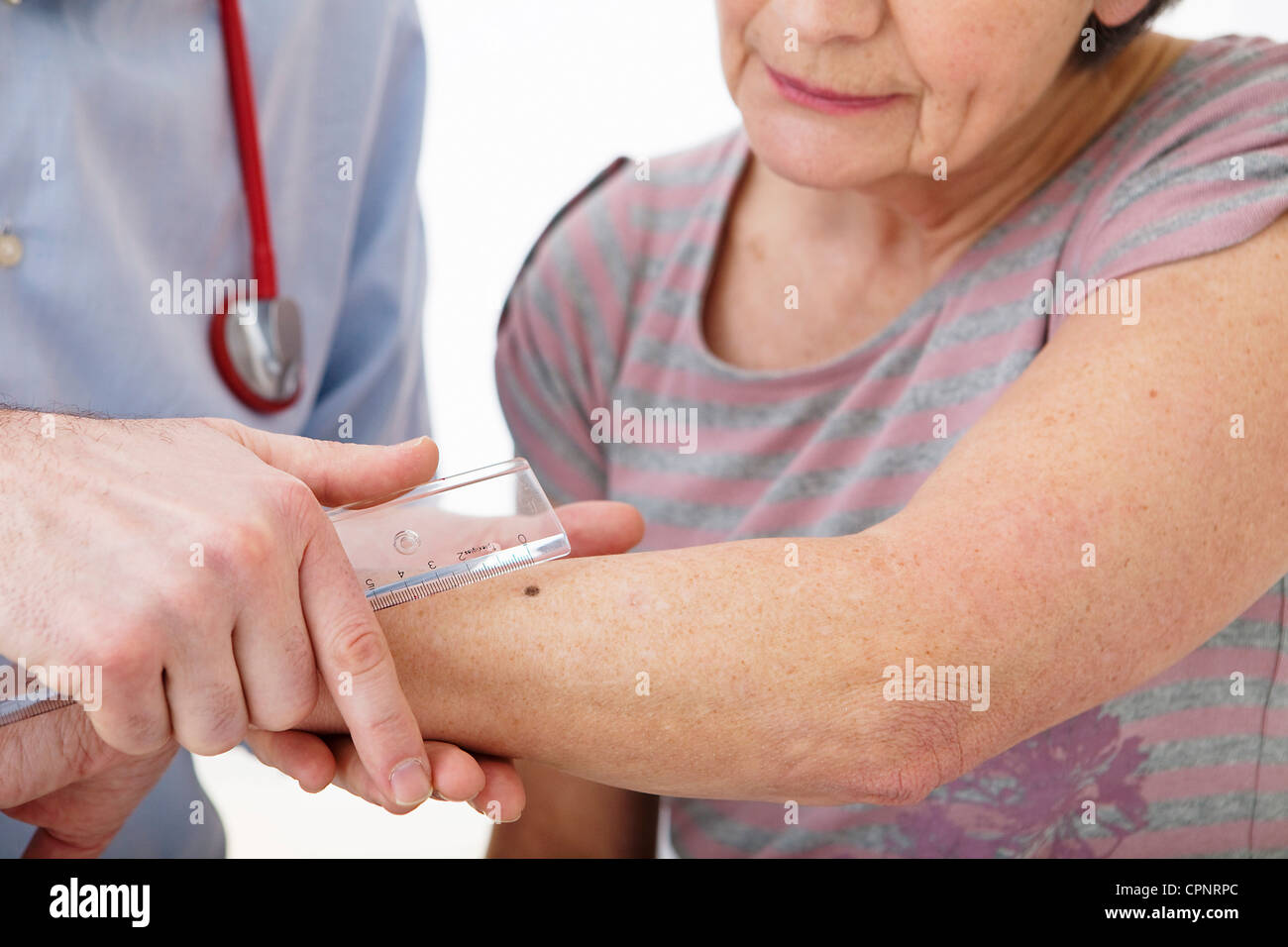 DERMATOLOGY, SYMPTOMATOLOGY ELDE Stock Photo - Alamy