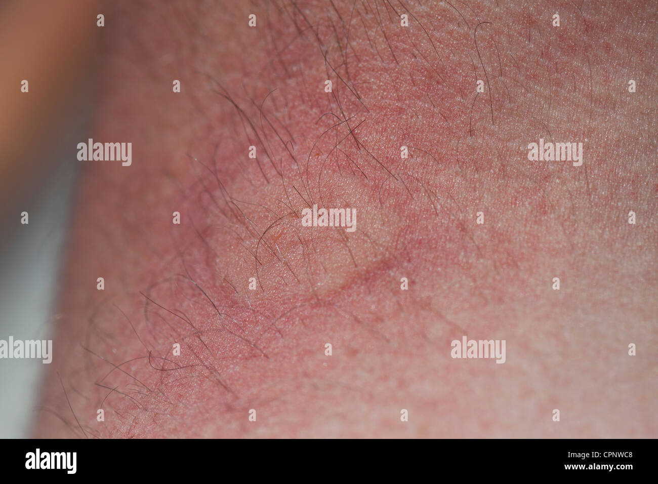 Poisonous skins hi-res stock photography and images - Alamy