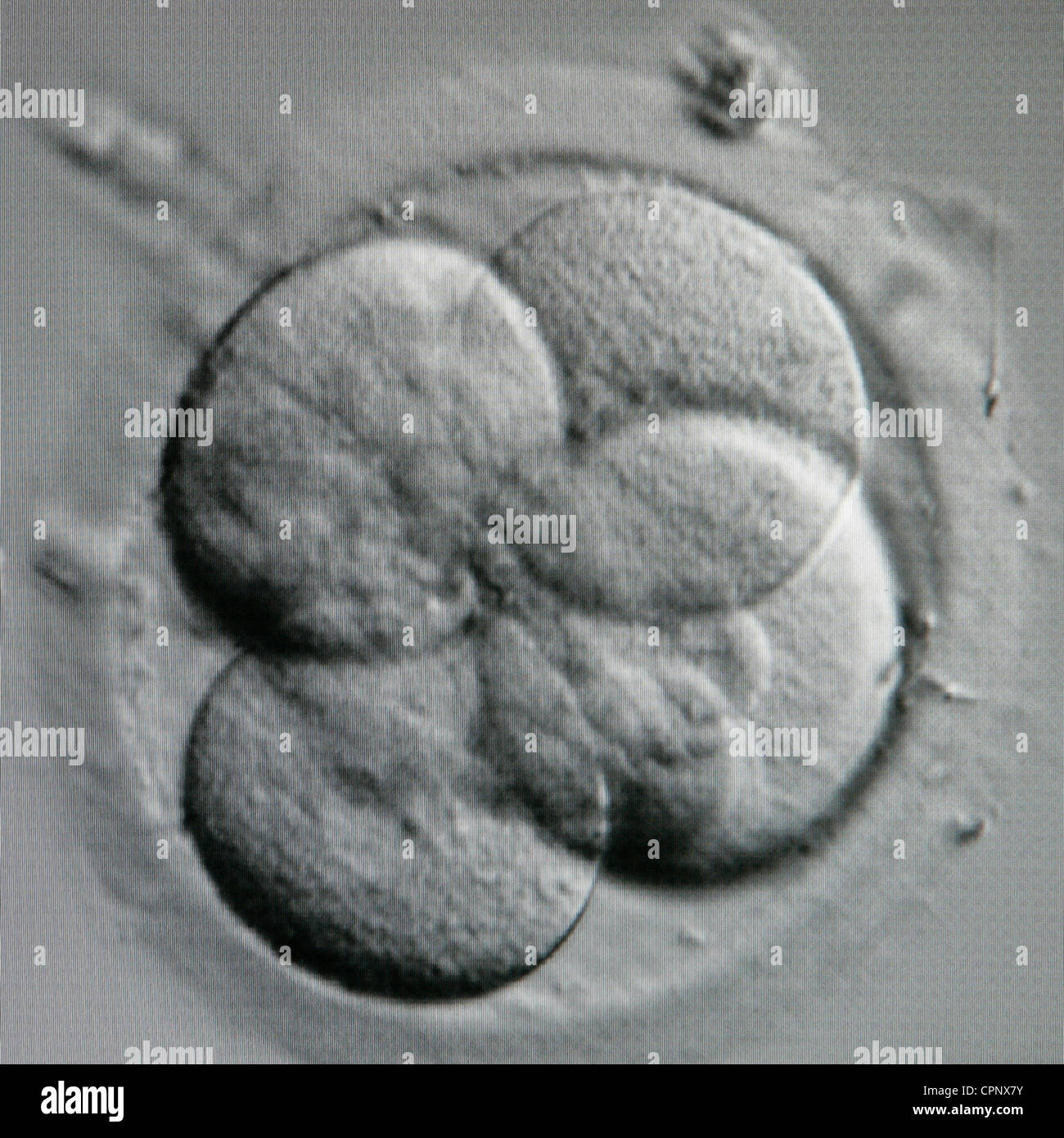 Human embryo micrograph hi-res stock photography and images - Alamy