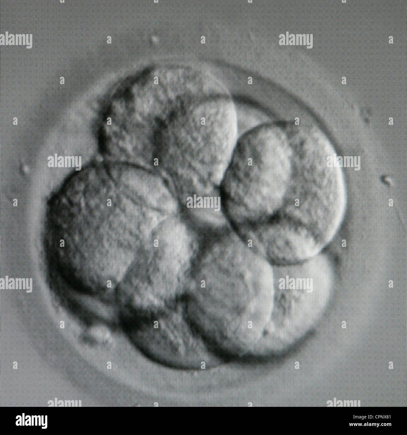 Human embryo micrograph hi-res stock photography and images - Alamy