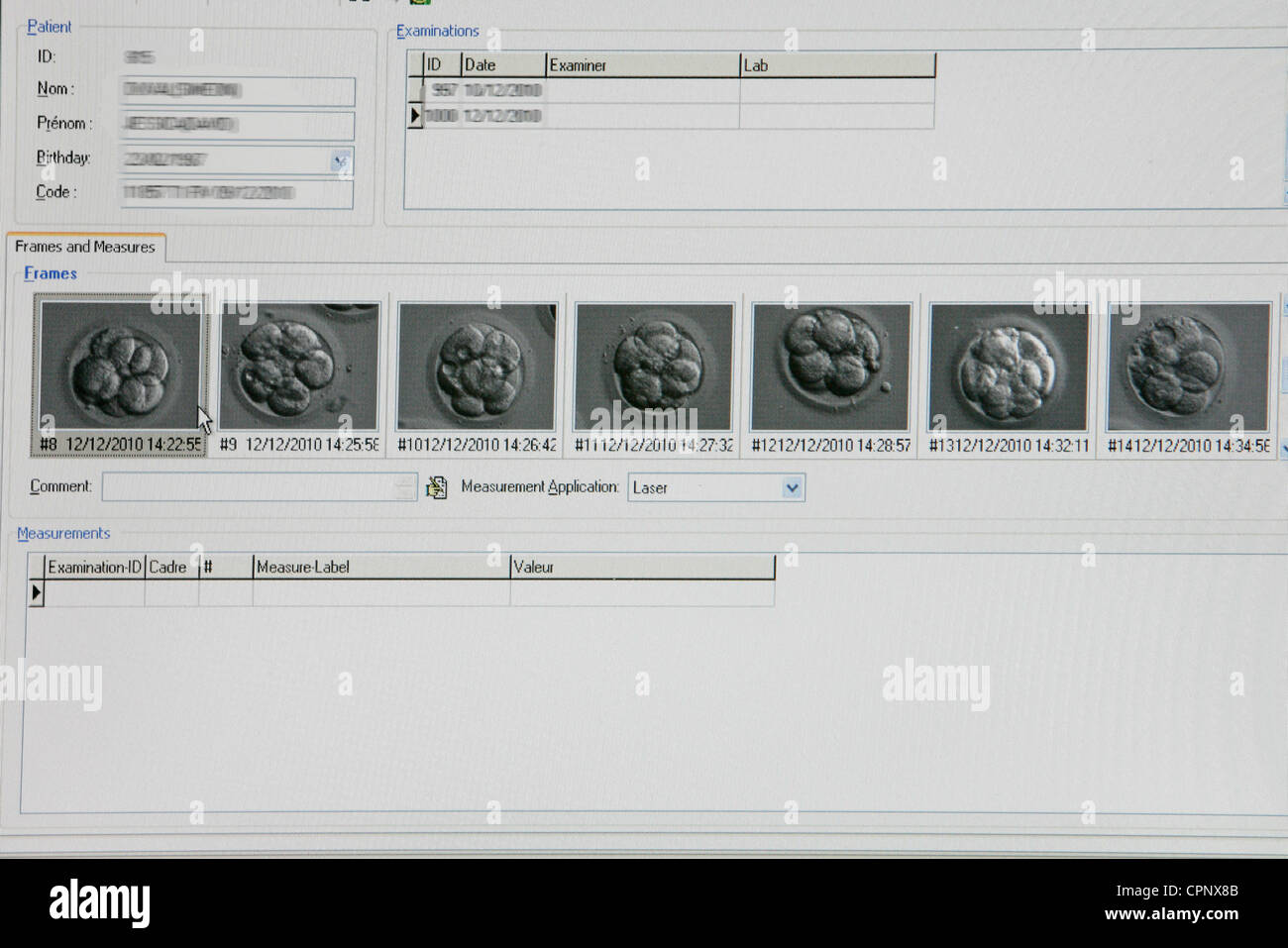 Icsi hi-res stock photography and images - Alamy