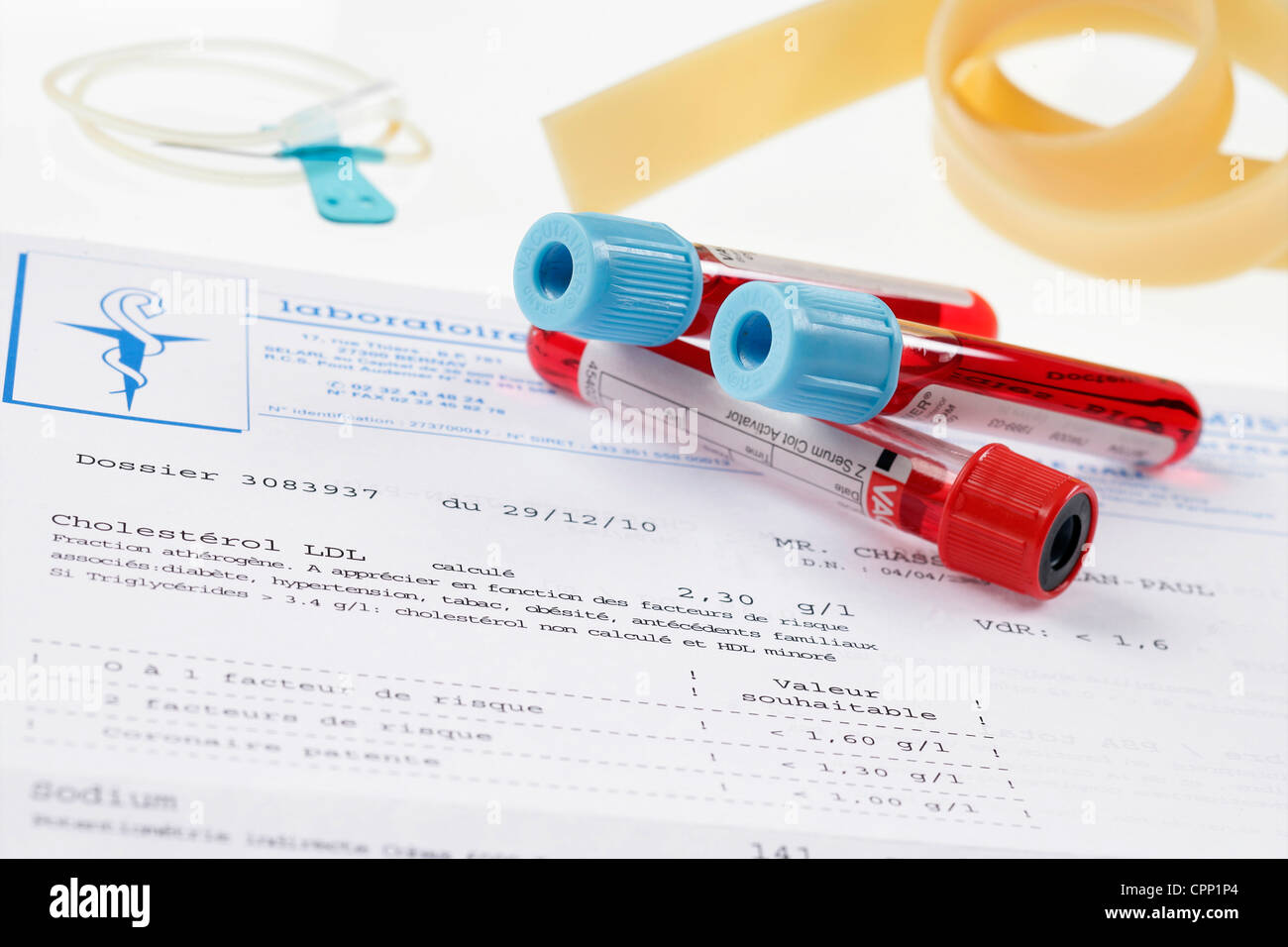 BLOOD ANALYSIS RESULT Stock Photo - Alamy