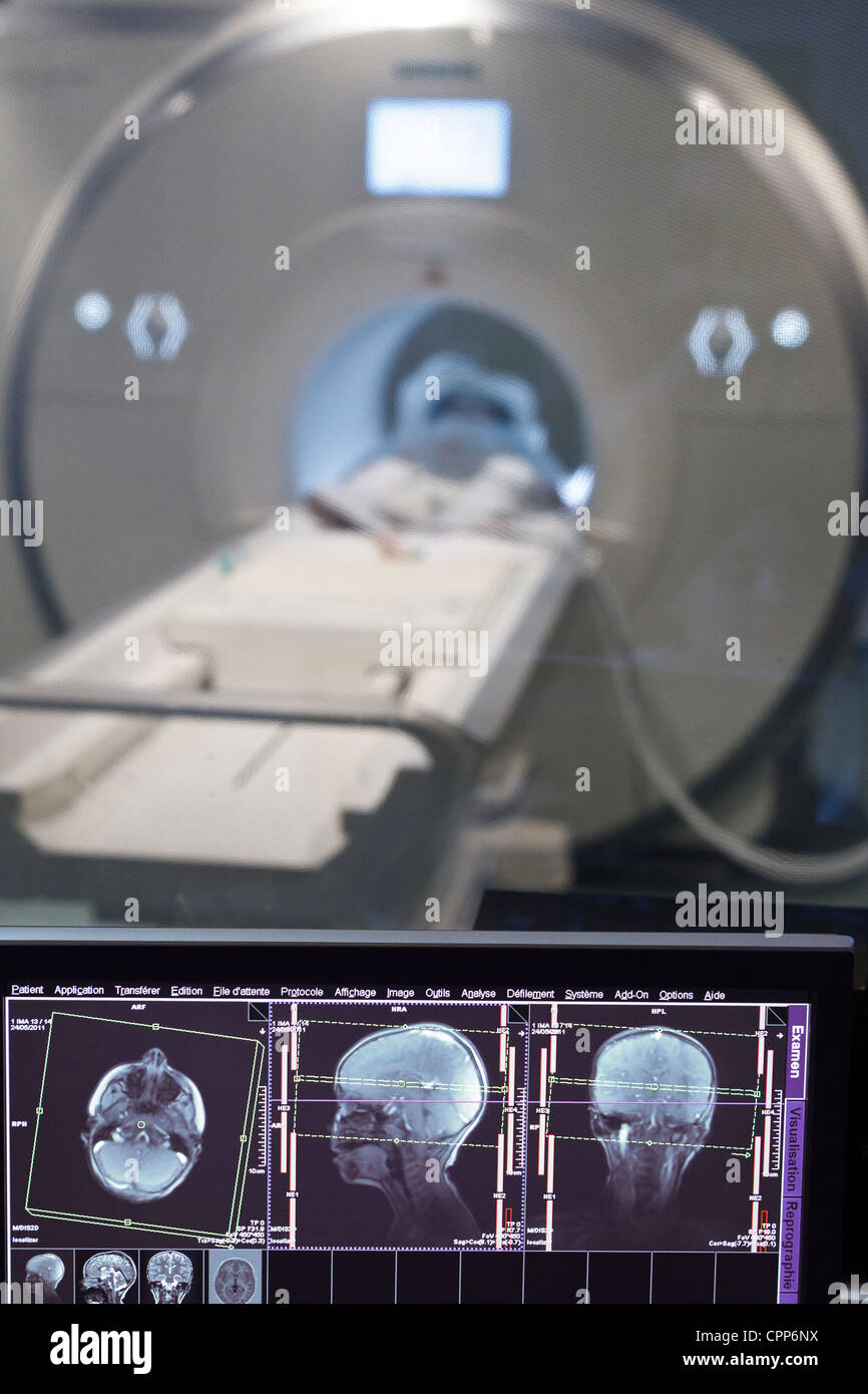 Old brain mri hi-res stock photography and images - Alamy