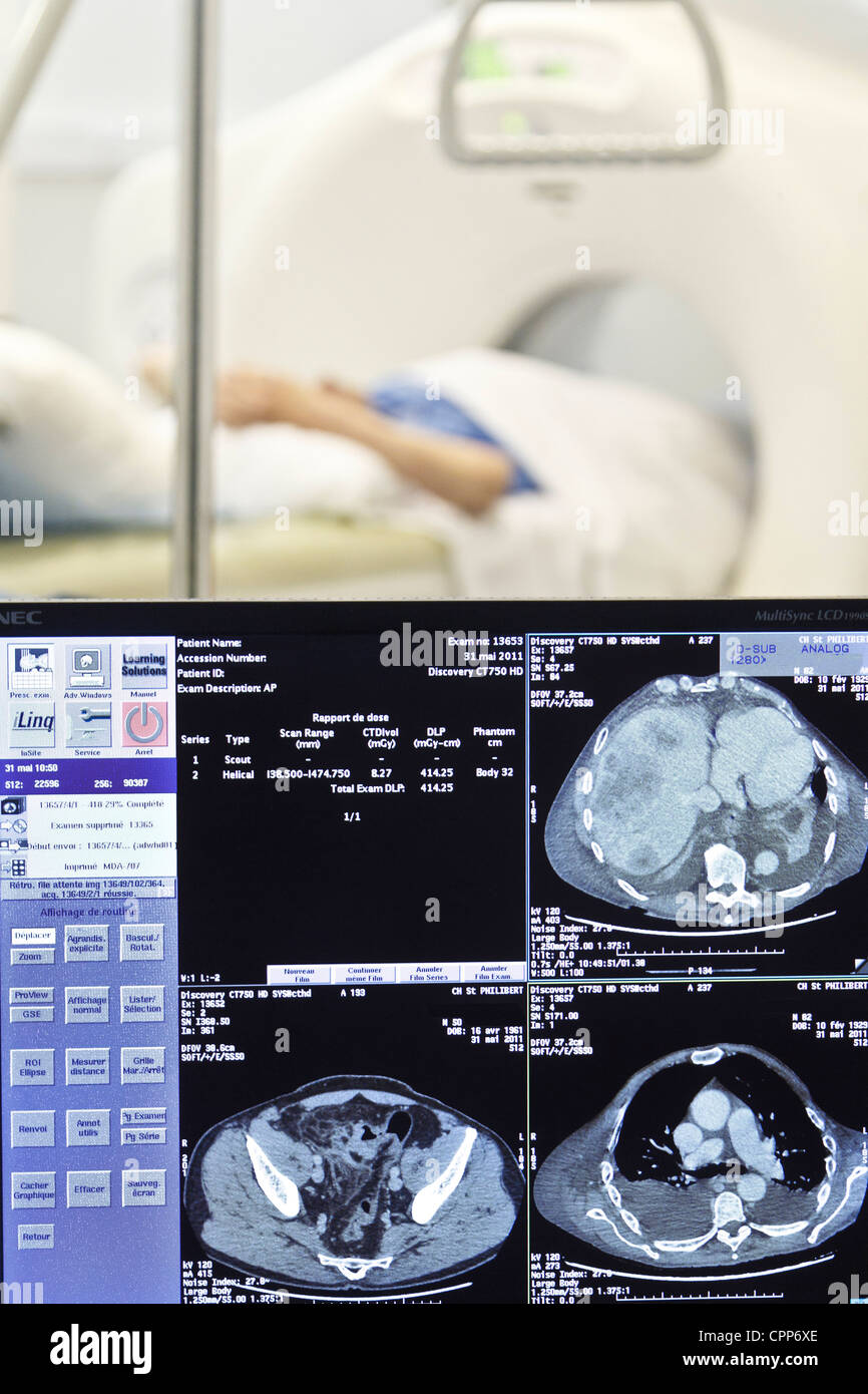 CT SCANNER EXAMINATION Stock Photo - Alamy