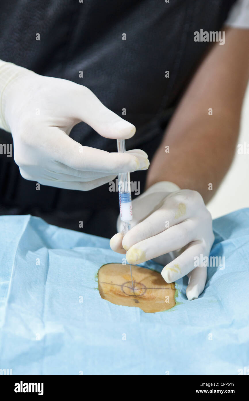 LUMBAR VERTEBRA, INFILTRATION Stock Photo - Alamy