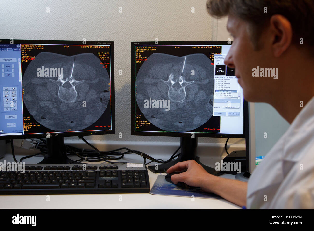 Spinal infiltration hi-res stock photography and images - Alamy