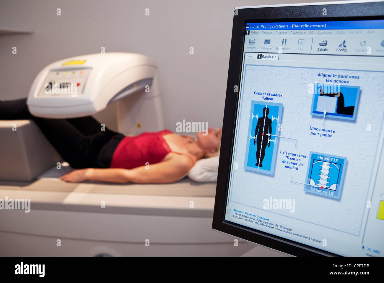 Bone Density Heel Screening Northern Nj
