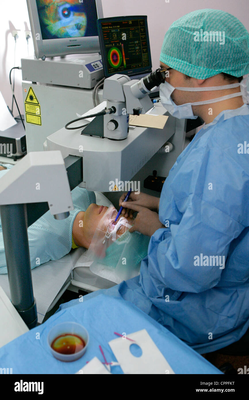 EYE LASER SURGERY Stock Photo - Alamy