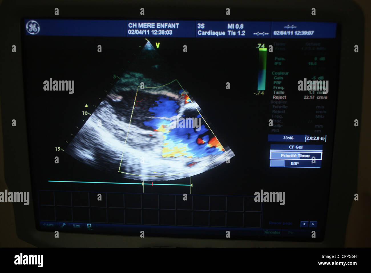 Doppler ultrasound hi-res stock photography and images - Alamy