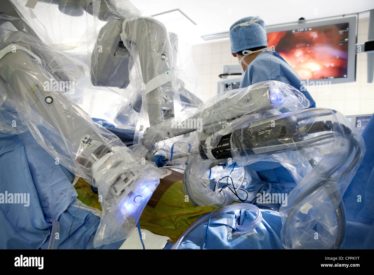 Endoscopy surgery hi-res stock photography and images - Alamy