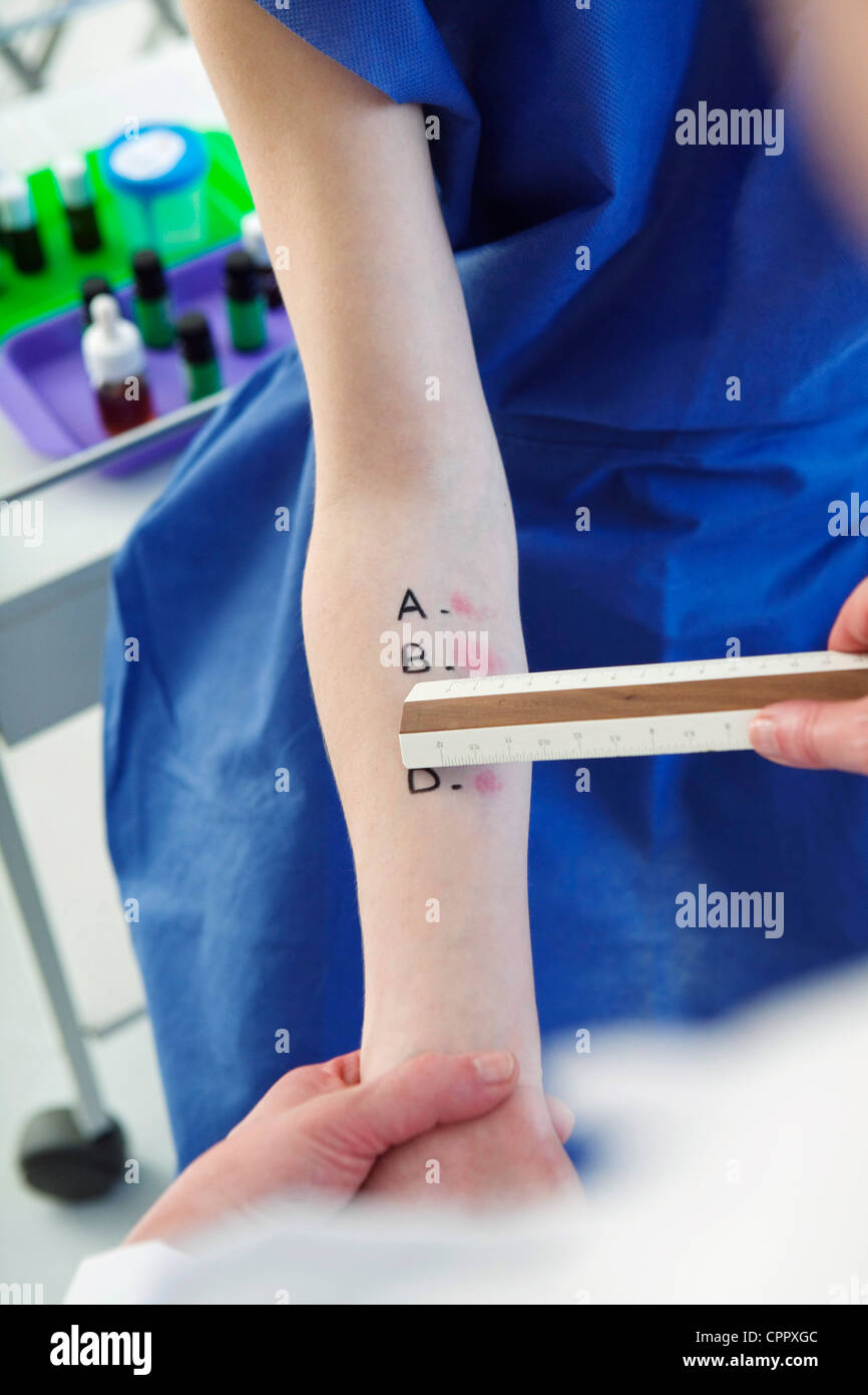 Skin test ruler hi-res stock photography and images - Alamy