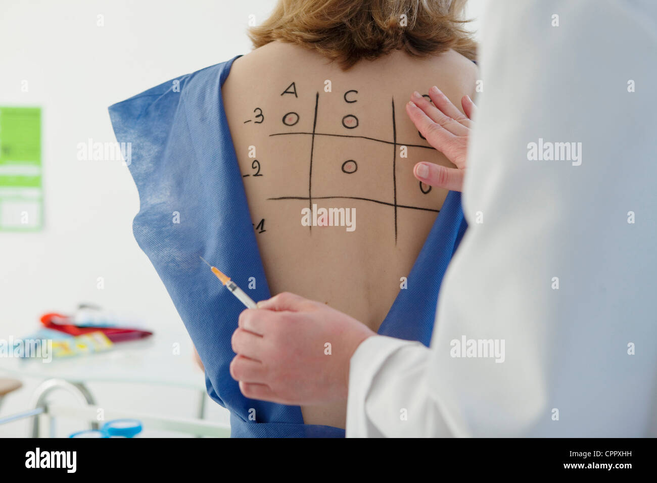 ALLERGY TEST, WOMAN Stock Photo - Alamy