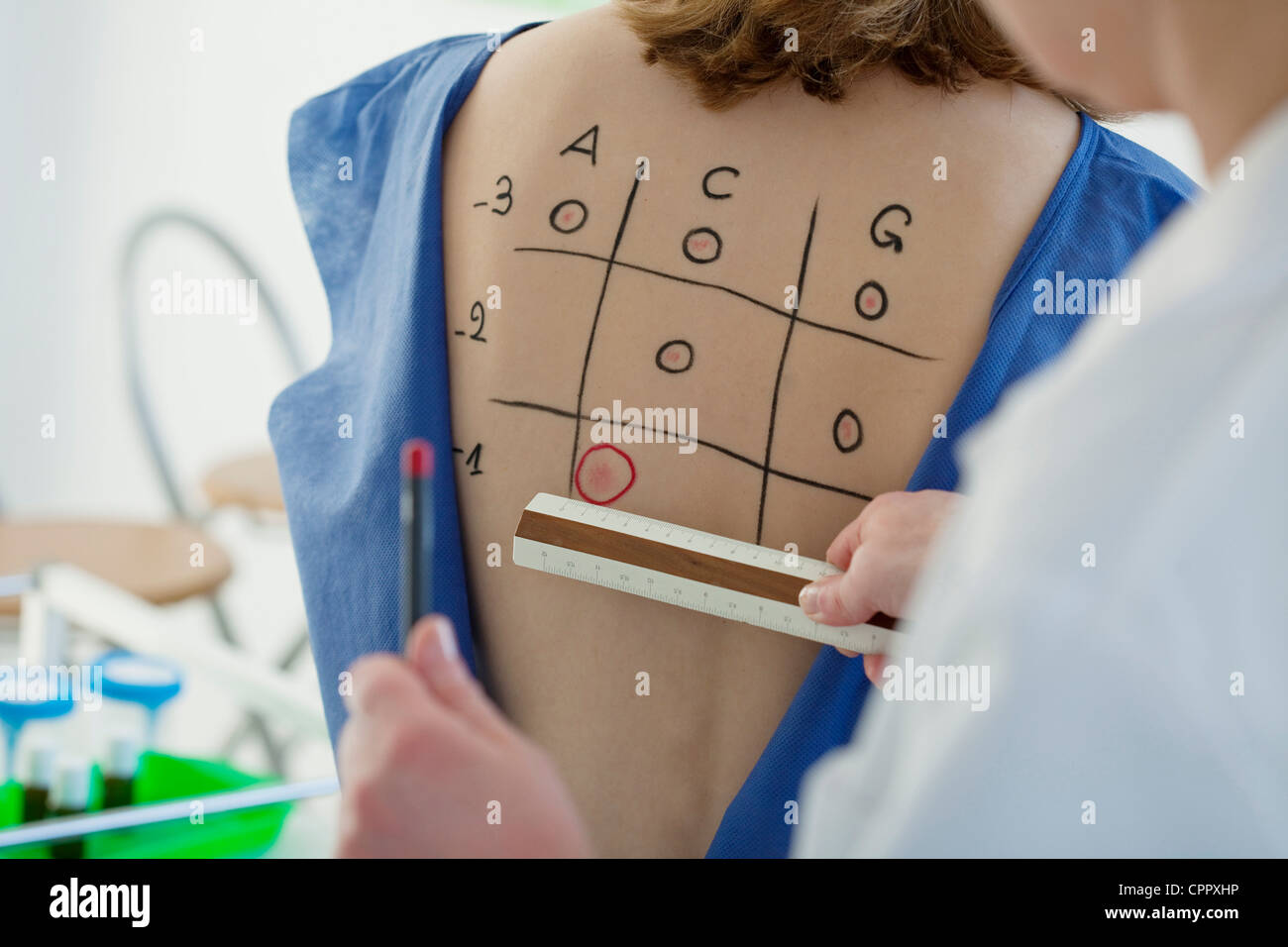 Skin test ruler hi-res stock photography and images - Alamy
