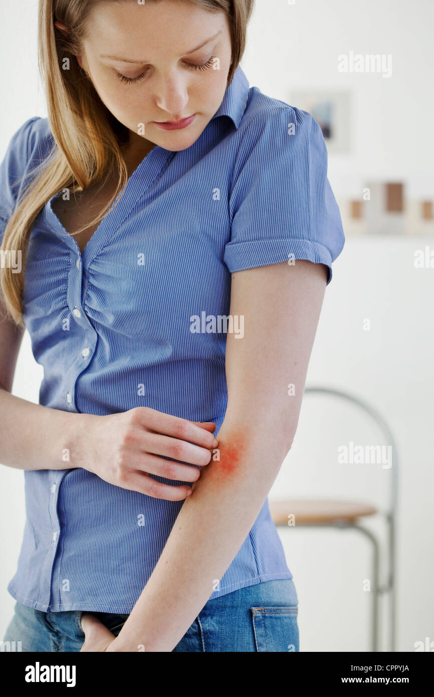 ITCHING IN A WOMAN Stock Photo - Alamy