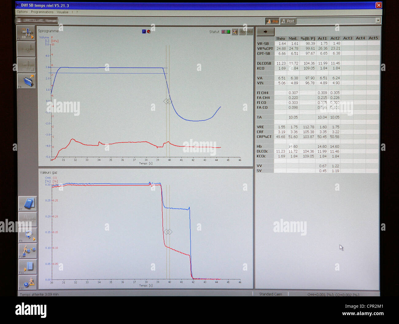 Pulmonary function test hi-res stock photography and images - Alamy