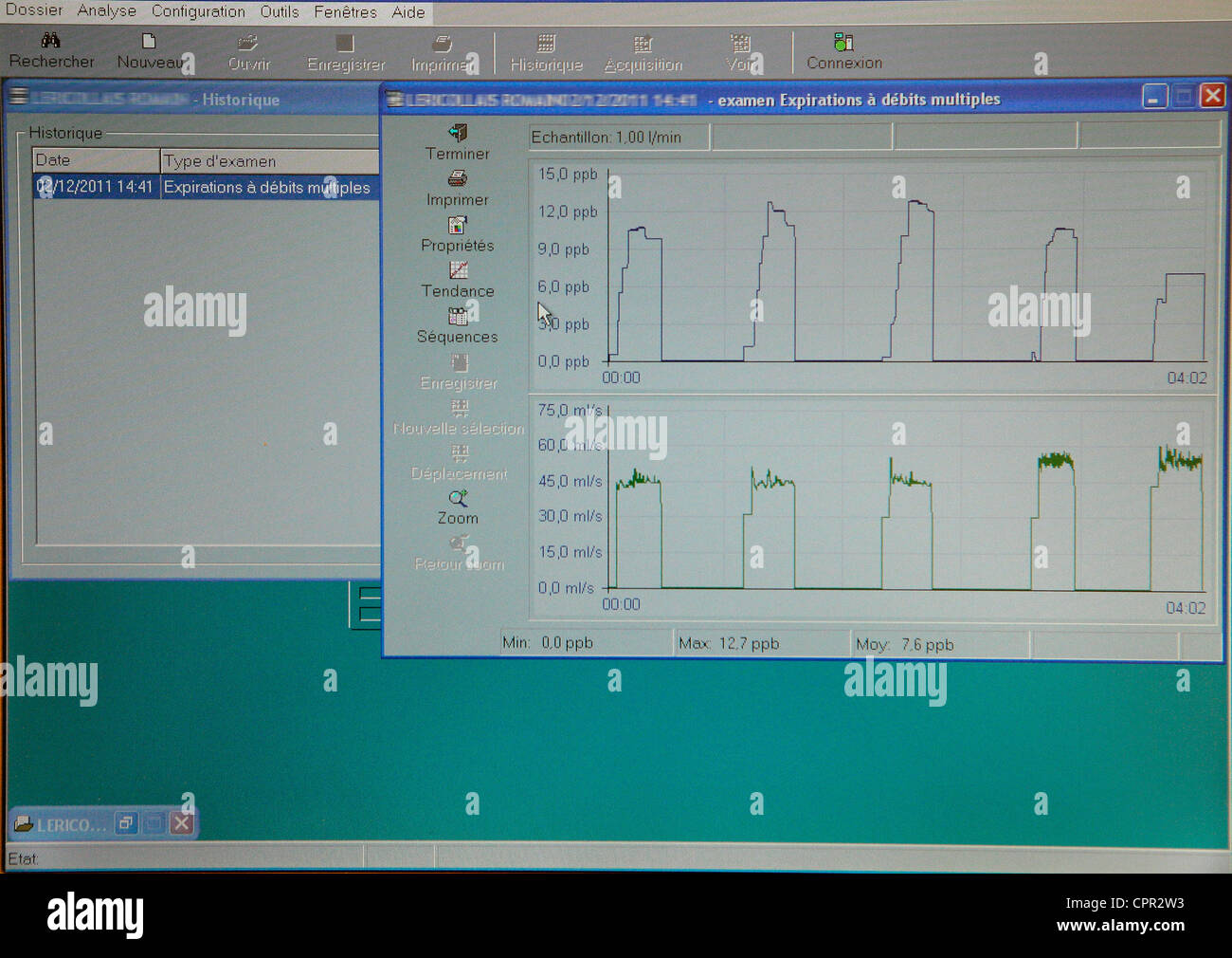 Spirometry result hi-res stock photography and images - Alamy