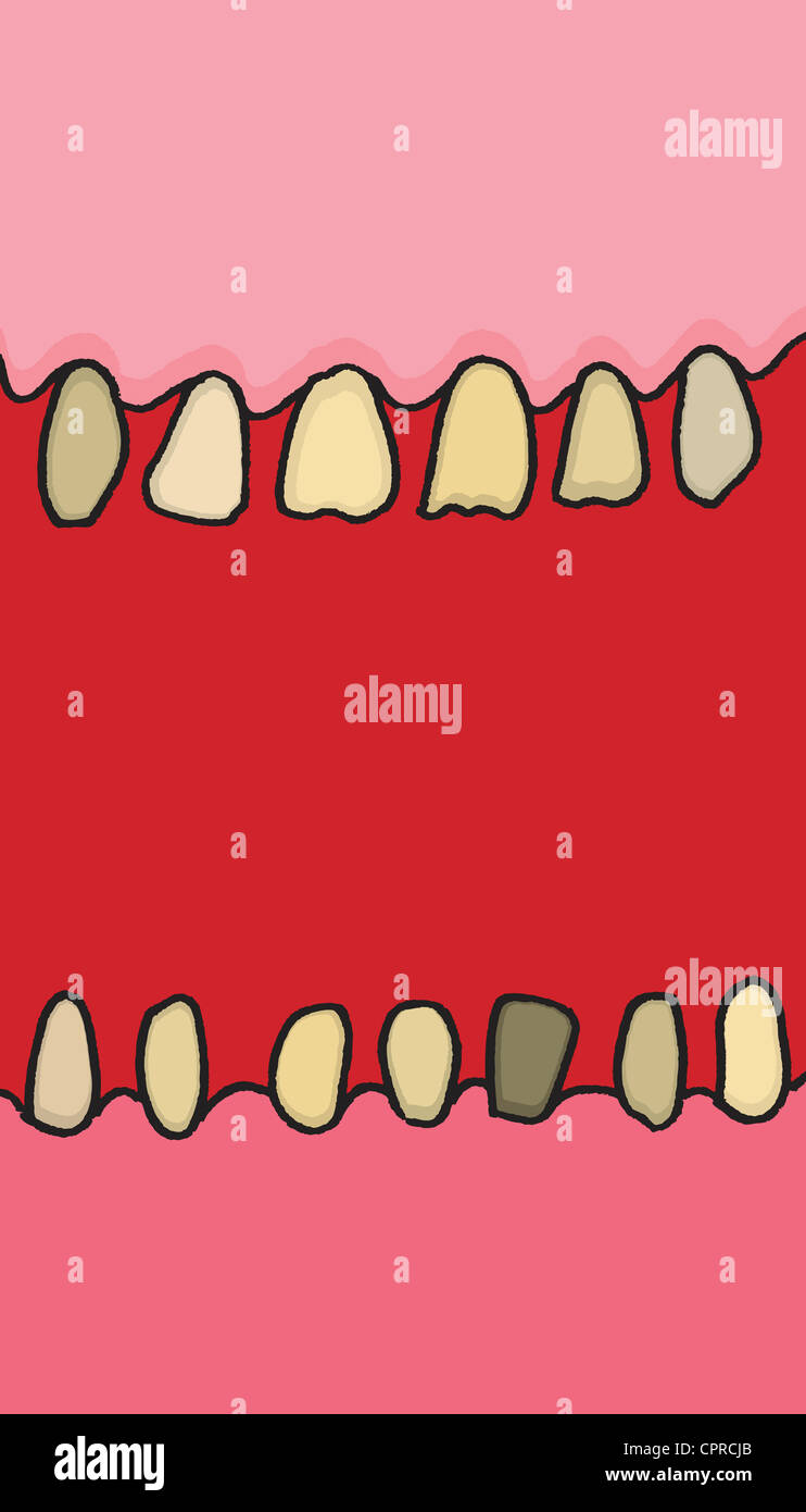 Mouth with decaying dental health Stock Photo - Alamy