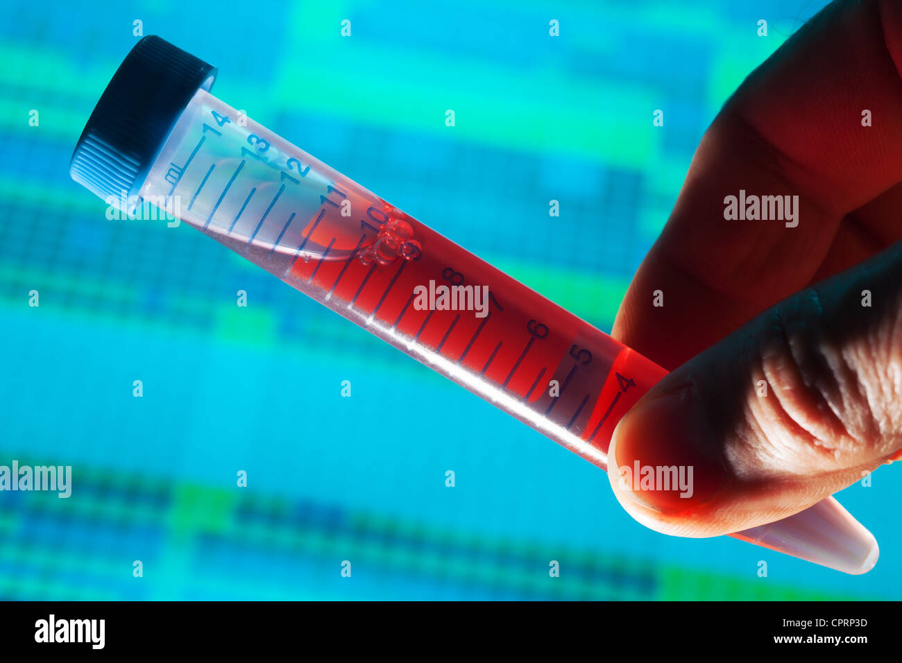 Blood In tube for laboratory analysis Stock Photo - Alamy