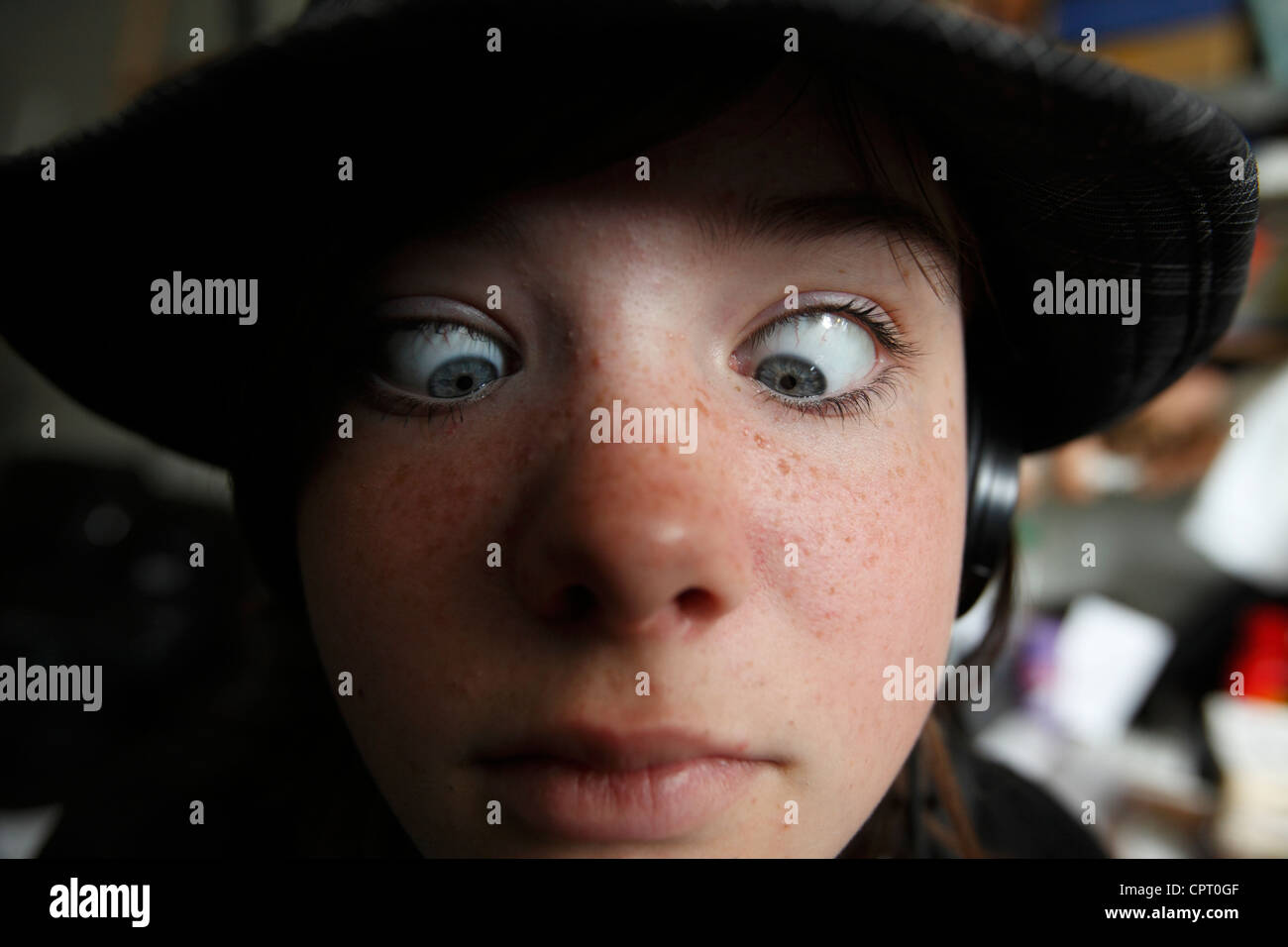 Girl with Crossed Eyes Stock Photo - Alamy
