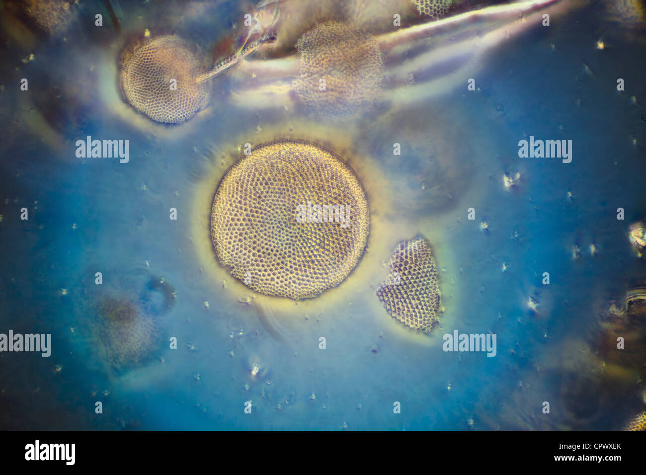 Darkfield photomicrograph, Pliocene fossil marine diatoms, Oran Algeria ...