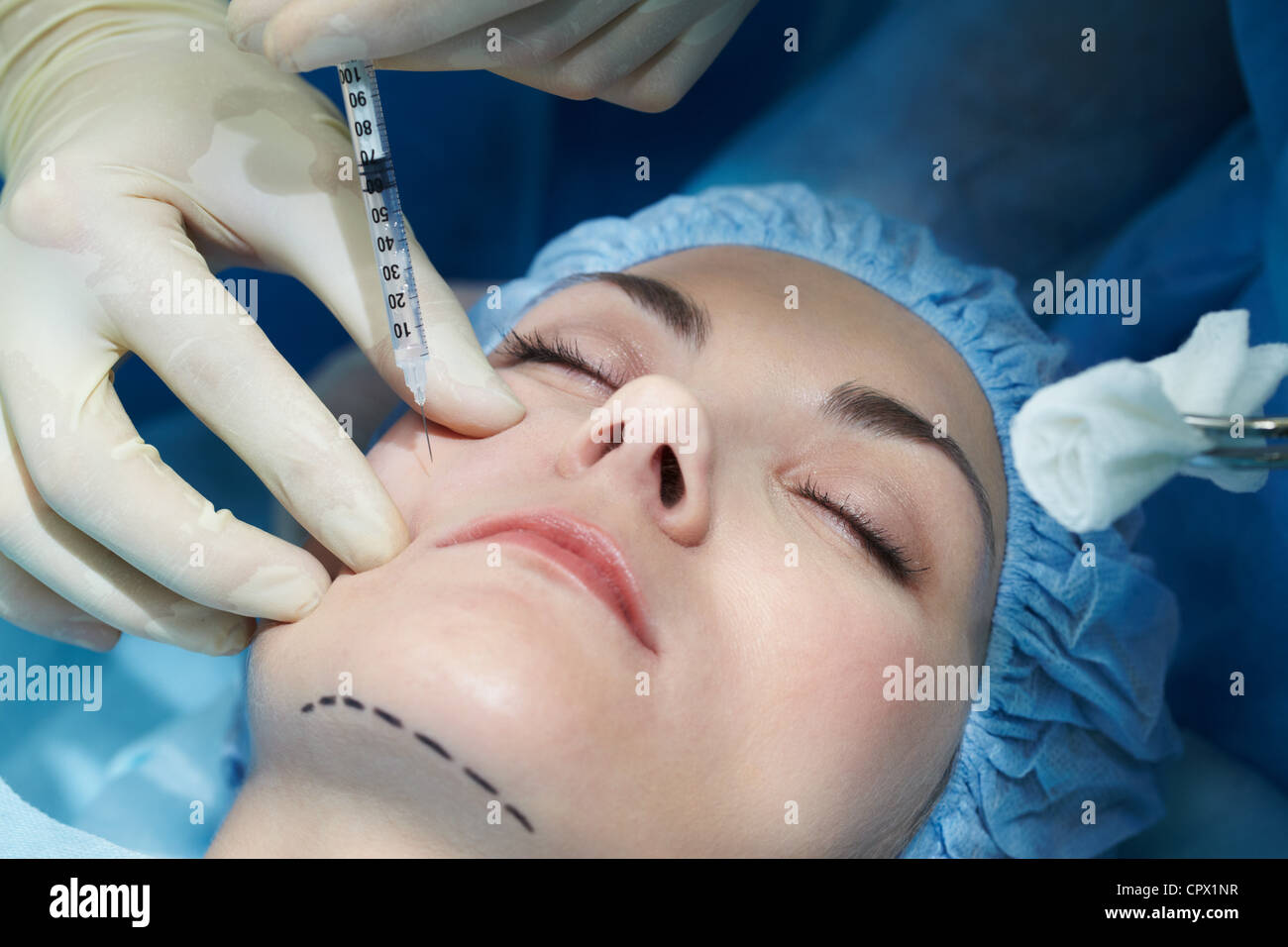 Woman Face Plastic Surgery High Resolution Stock Photography and Images ...