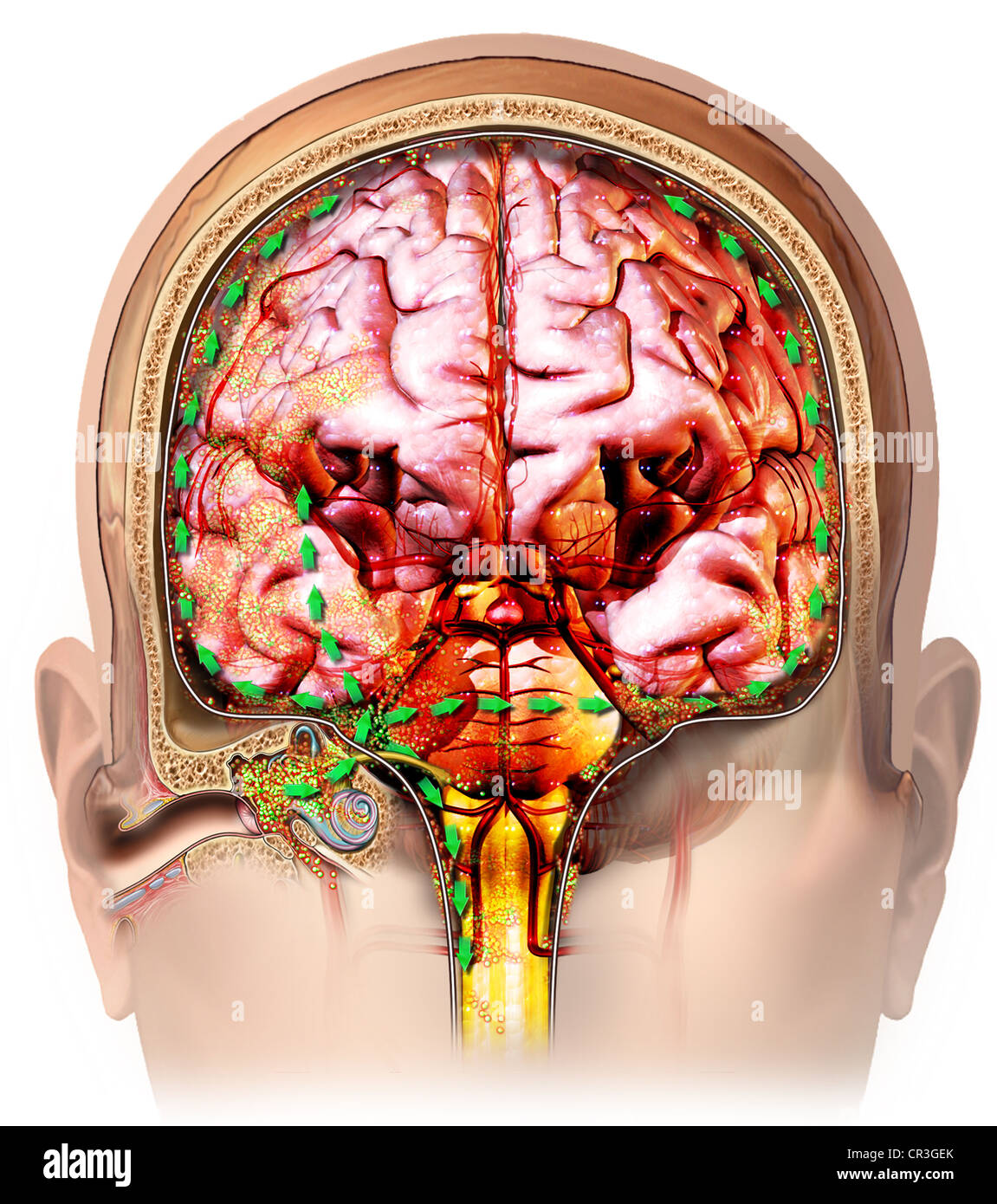 Bacterial meningitis meninges hi-res stock photography and images - Alamy