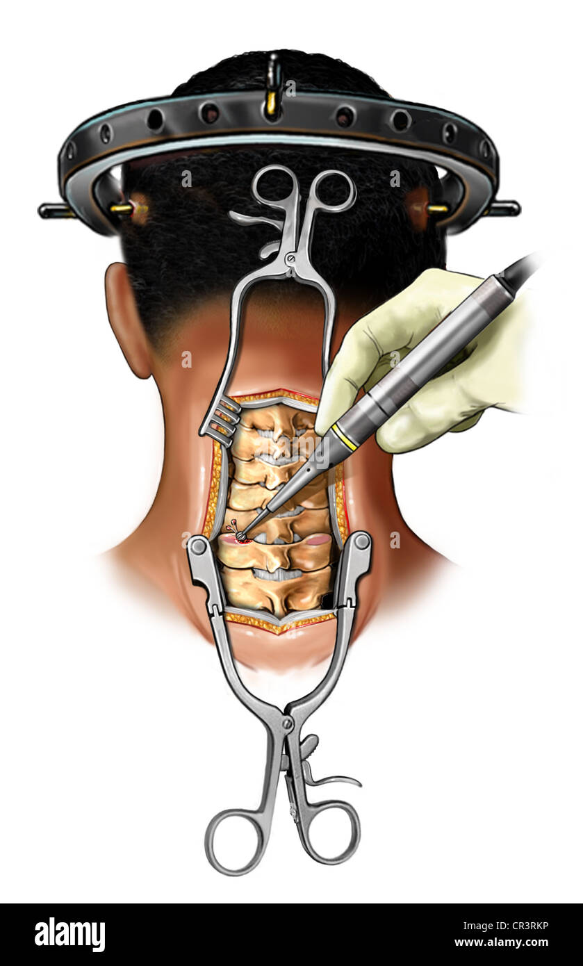 C7 t1 hi-res stock photography and images - Alamy