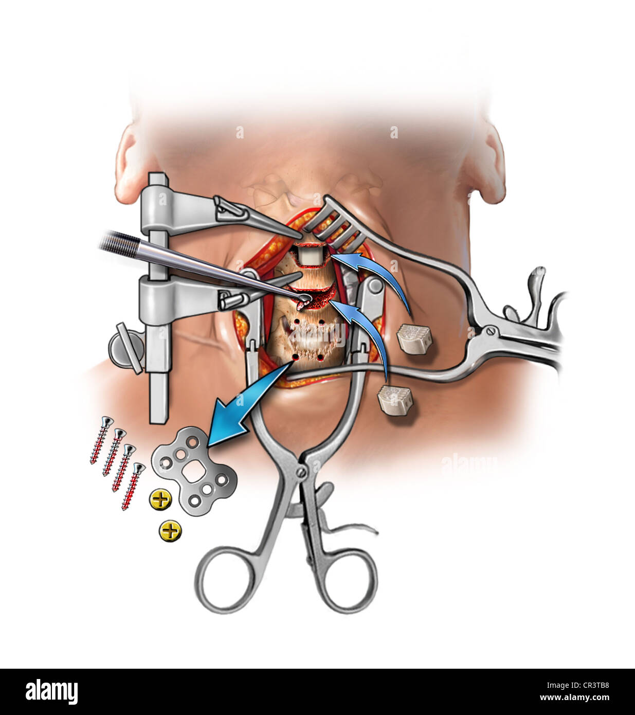 C3 fusion hi-res stock photography and images - Alamy