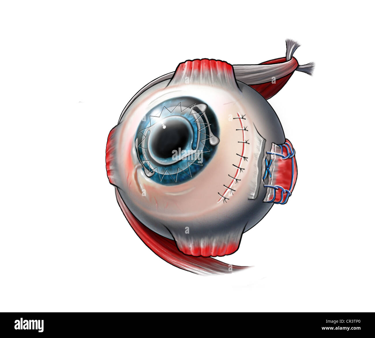 Rectus muscle hi-res stock photography and images - Alamy