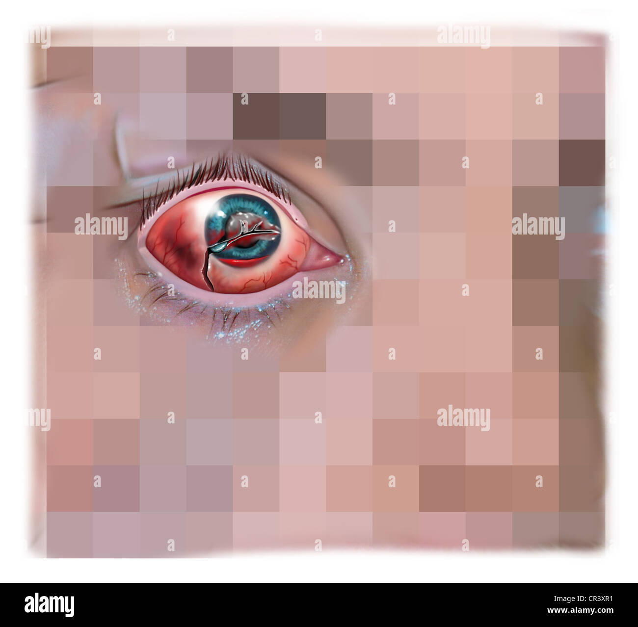 Sclera High Resolution Stock Photography and Images - Alamy