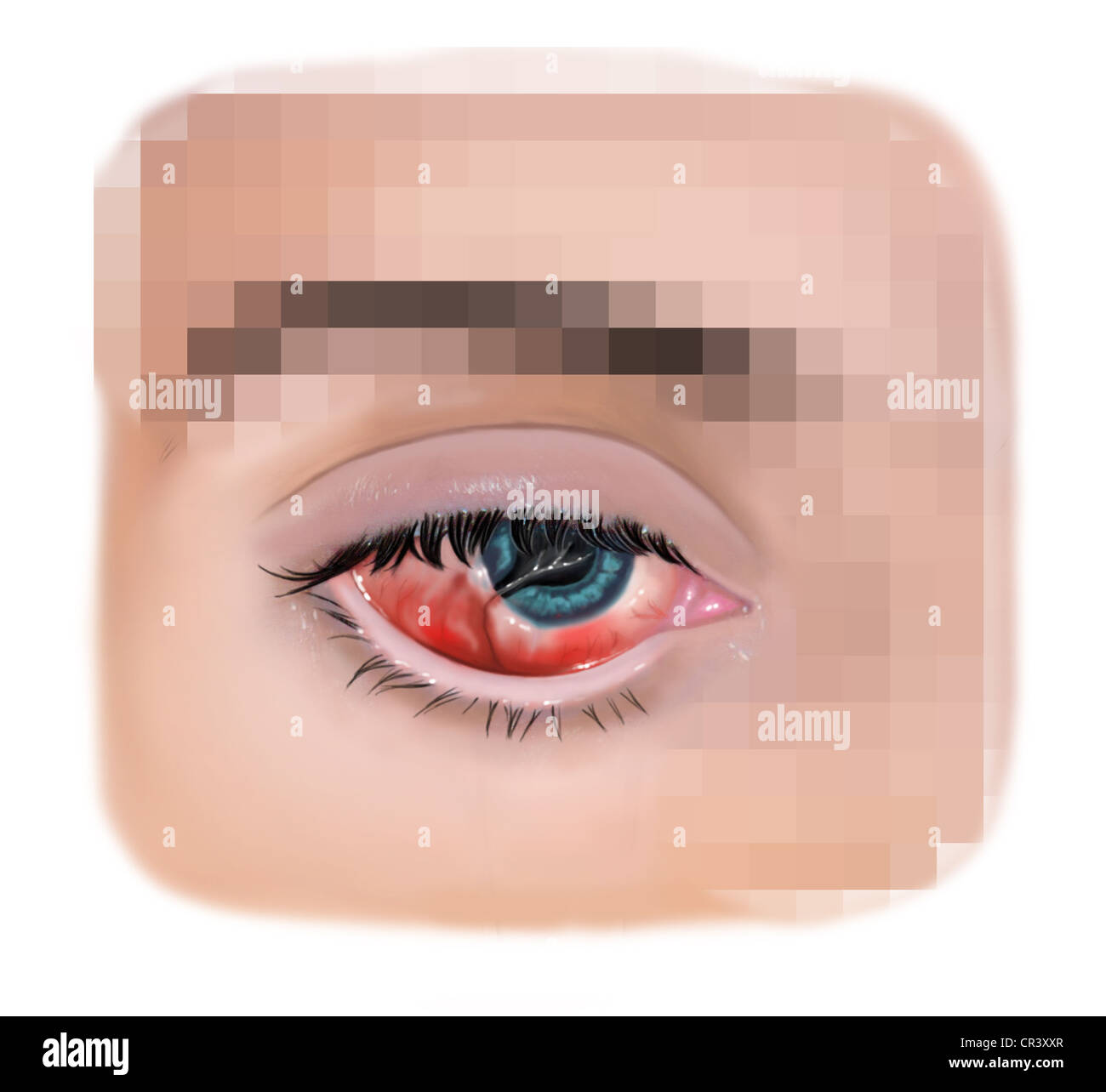 Laceration hi-res stock photography and images - Alamy