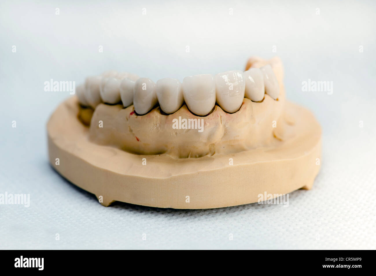 Upper jaw model with ceramic crowns Stock Photo - Alamy