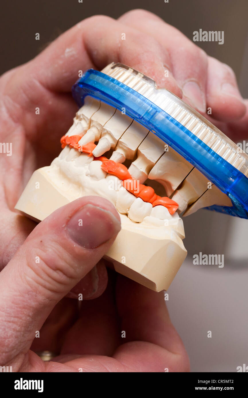 Dental model with upper and lower jaw Stock Photo - Alamy