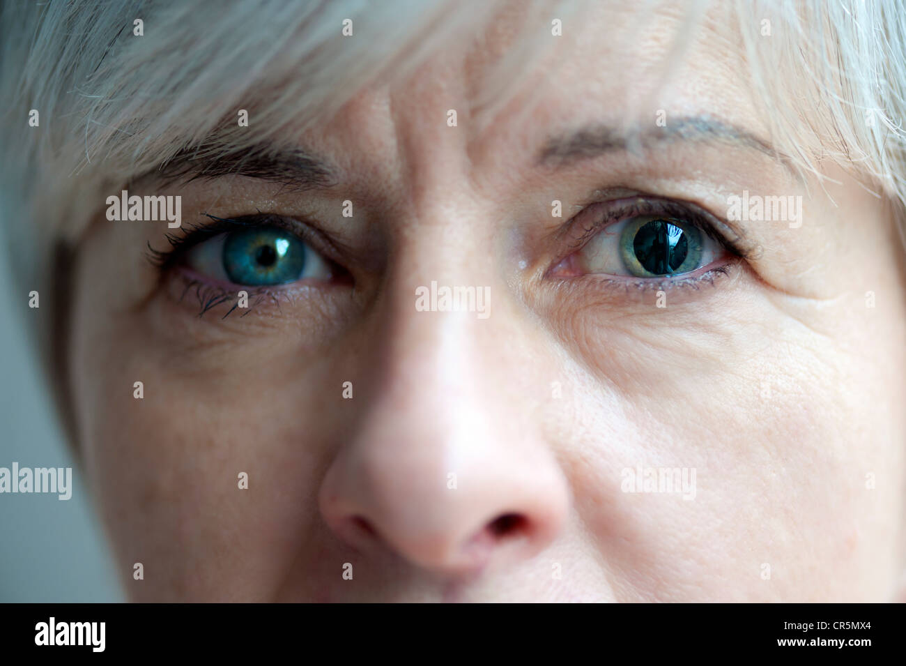 Eyes of a woman with one large and one small pupil Stock Photo - Alamy